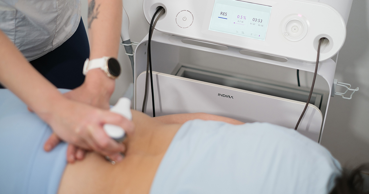 INDIBA – napredna terapija za brži oporavak | Body Lab